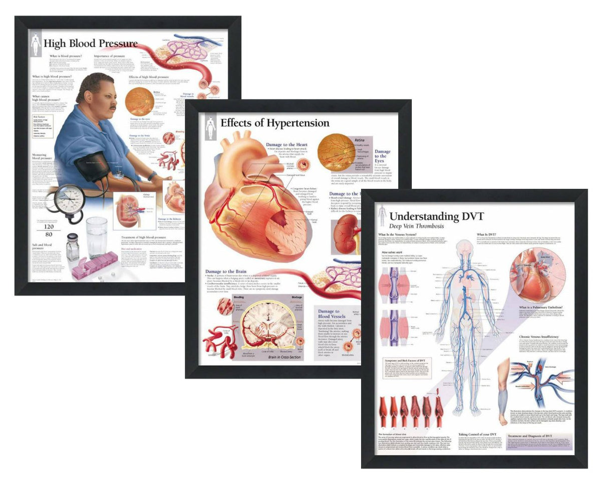 Framed Medical Posters – WTSpeak