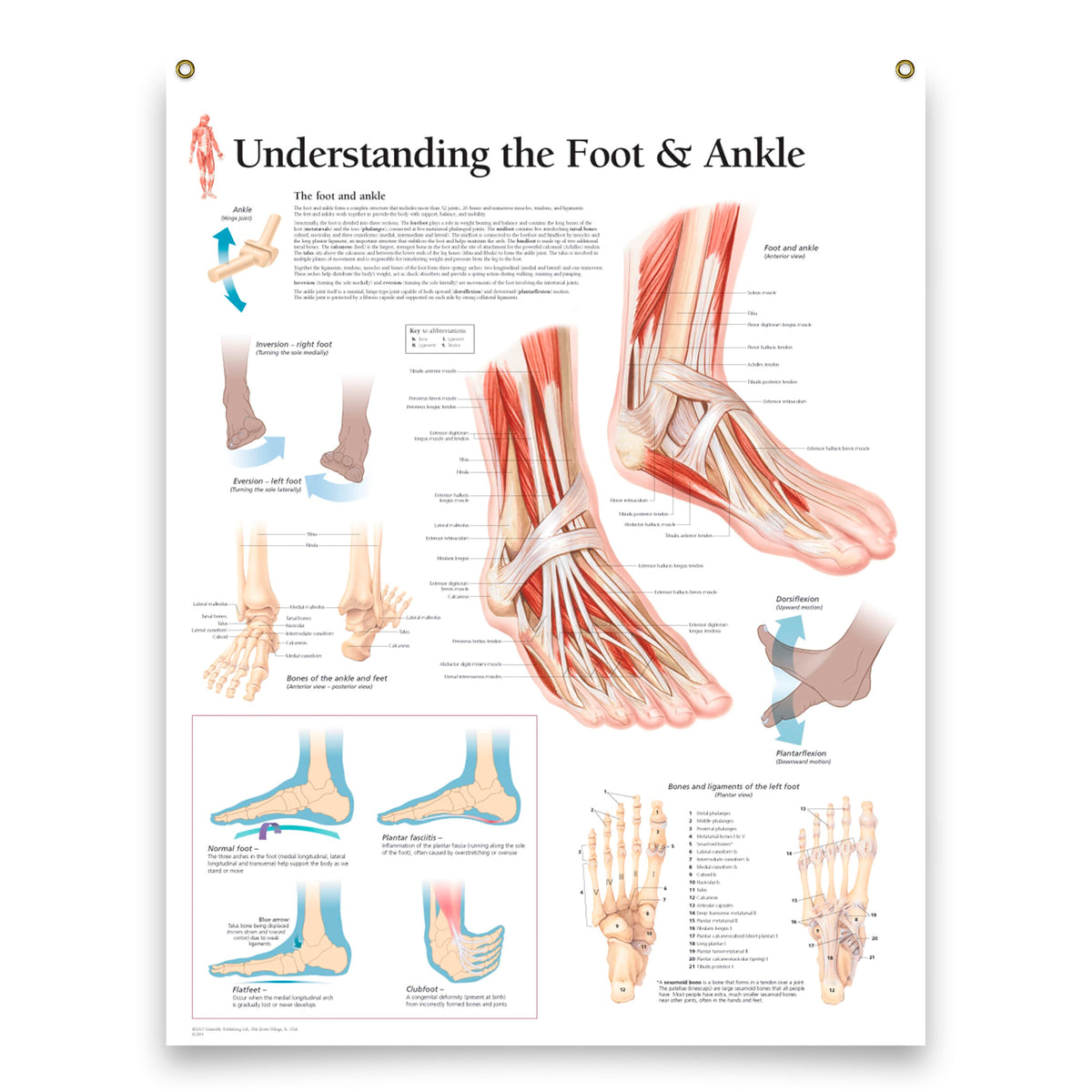 Set of 4 Laminated Medical Posters Understanding The Hip and Knee; Foo ...