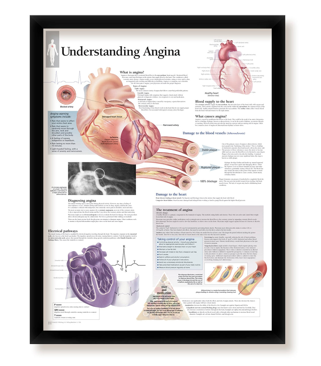 Set of 3 Framed Medical Posters Understanding PAD Understanding Angina ...