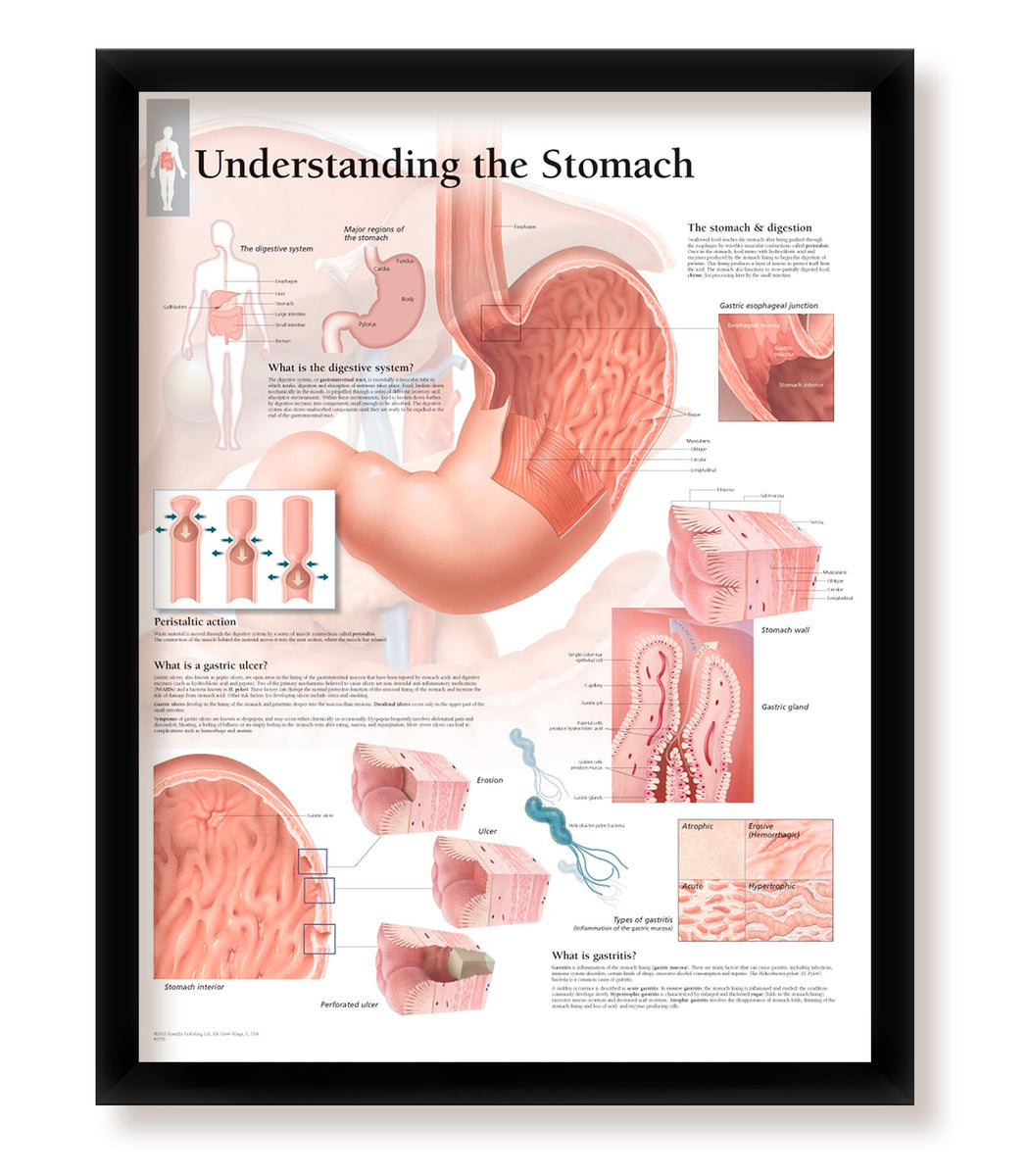 Set of 6 Framed Medical Posters The Stomach; Understanding The Stomach ...