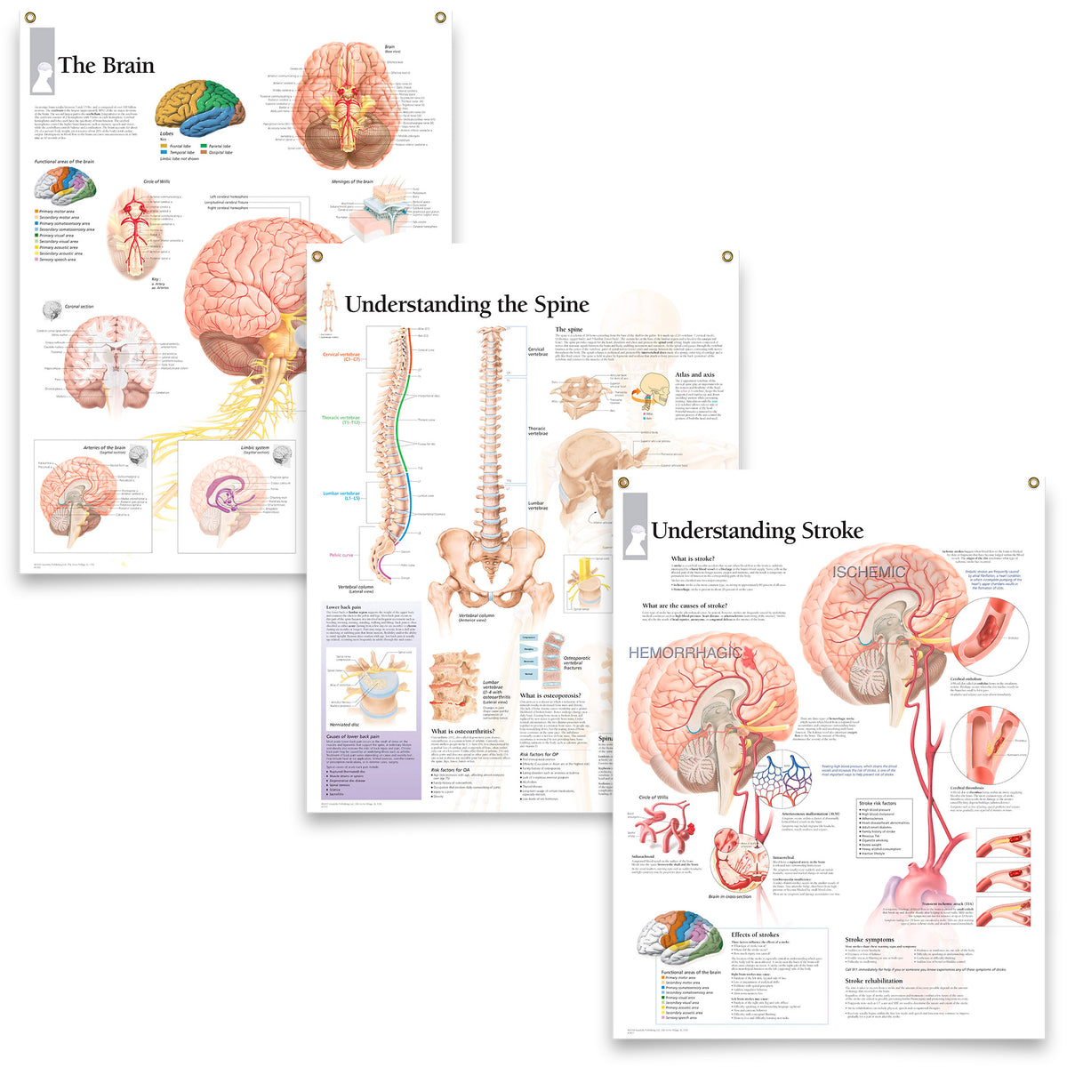 Set of 3 Laminated Understanding the Spine Brain and Stroke Art Poster ...